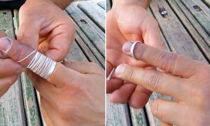 Easy Tricks To Remove A Tight Finger Ring