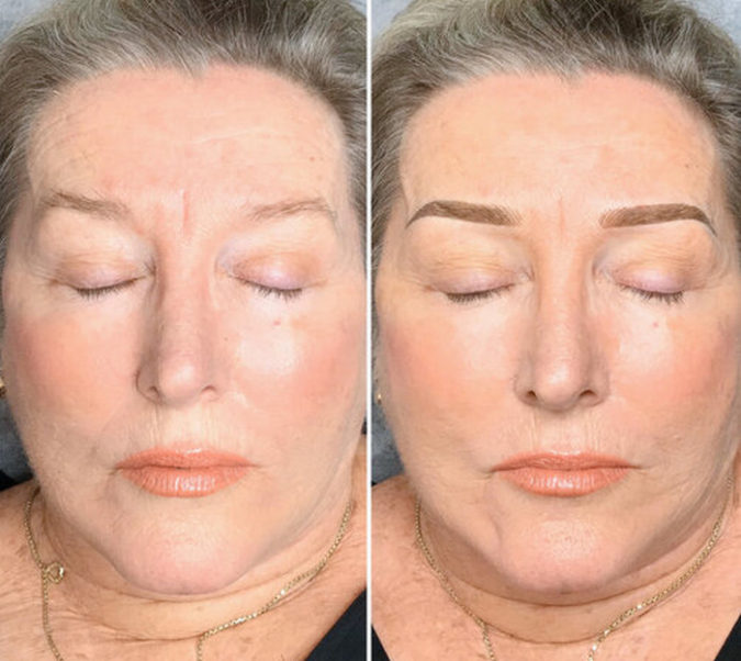 Top 10 Eyebrows Makeup Tips For Women Over 50 To Look Younger